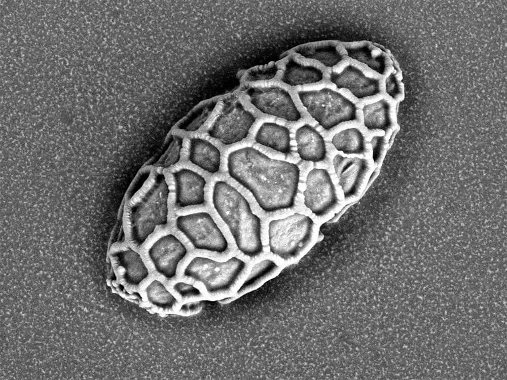 Timothy | Amazing microscopic world | JEOL Ltd.