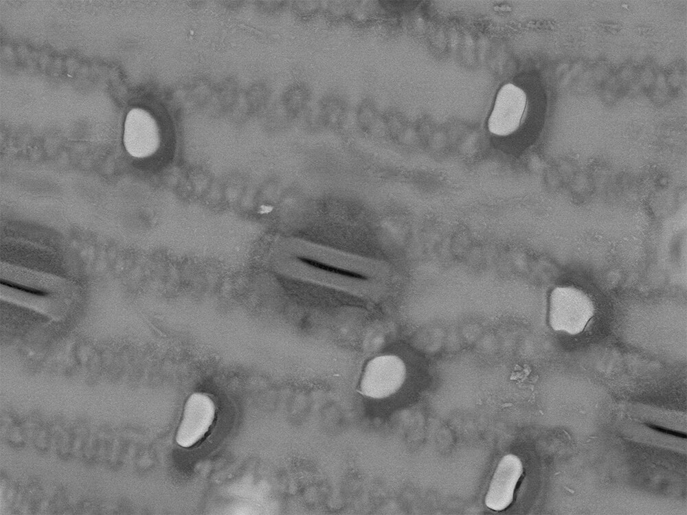 Timothy | Amazing microscopic world | JEOL Ltd.