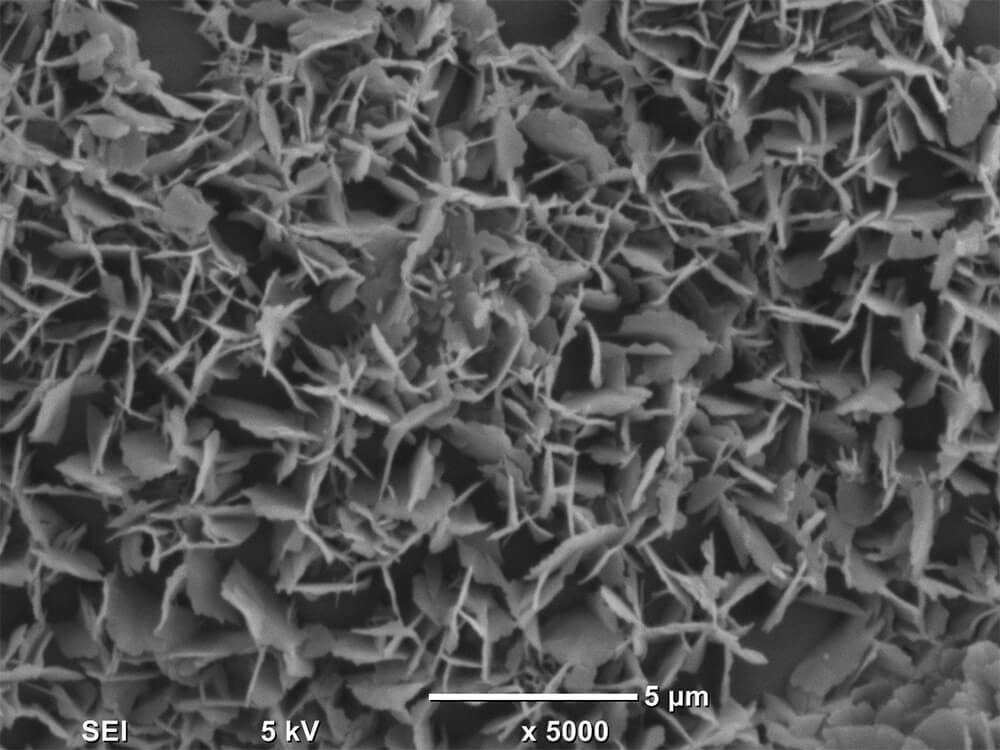 Timothy | Amazing microscopic world | JEOL Ltd.