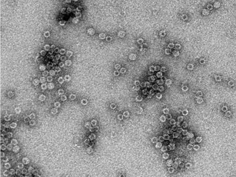 Ferritin | Amazing microscopic world | JEOL Ltd.