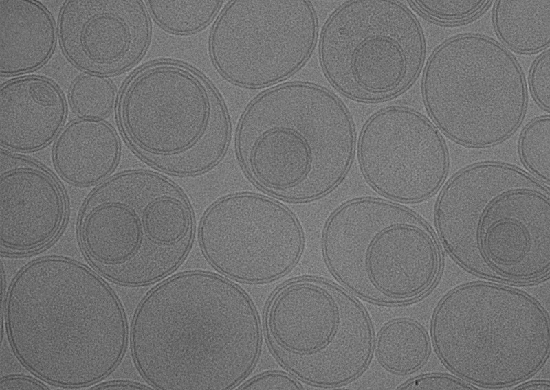 Liposome | Amazing microscopic world | JEOL Ltd.