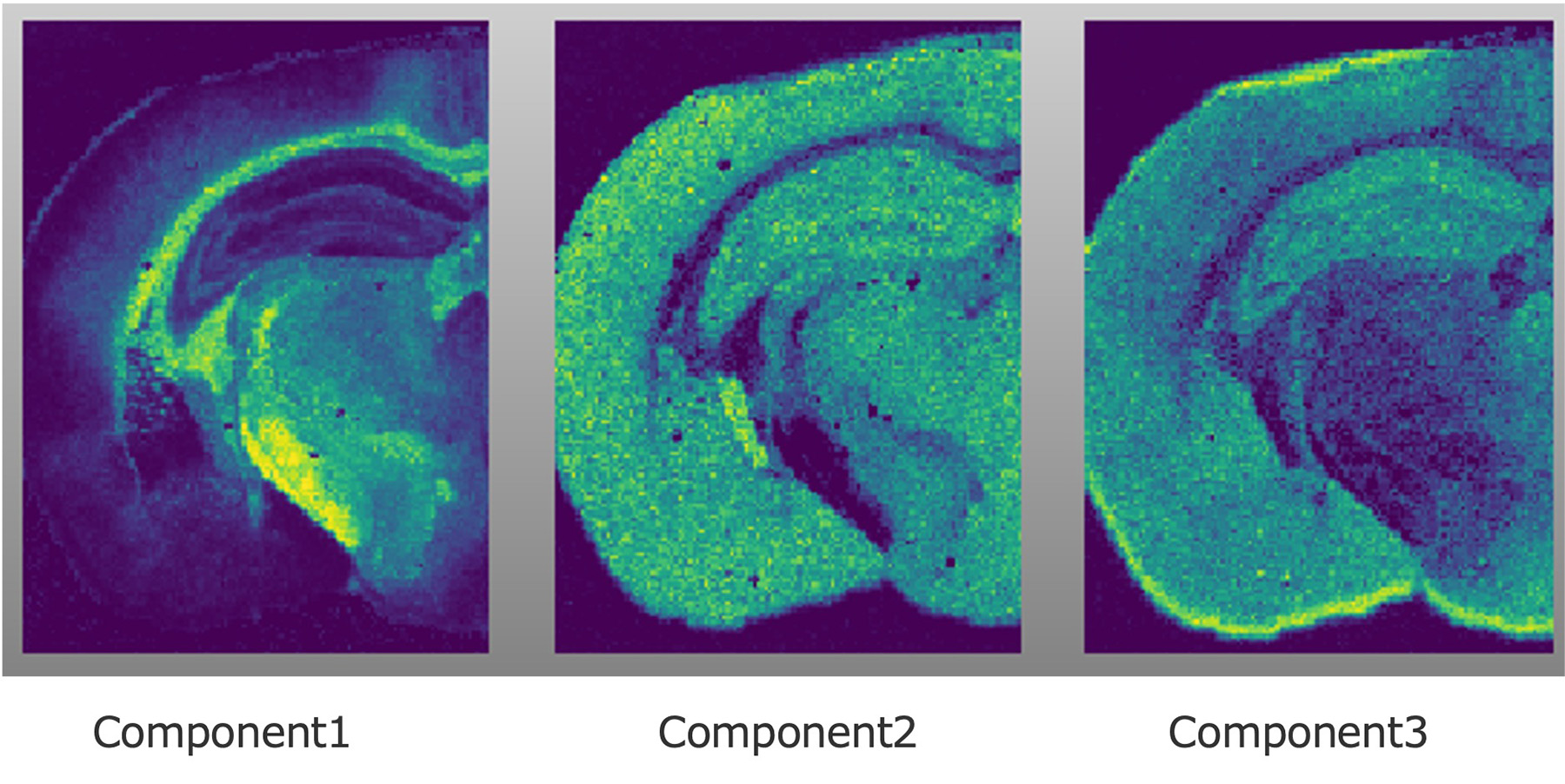 High mass-resolution MS imaging using JMS-S3000 "SpiralTOF™" and ...