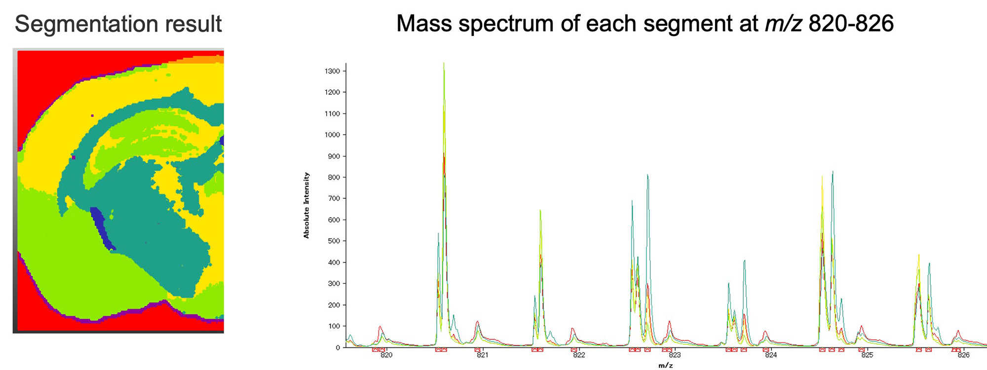 High mass-resolution MS imaging using JMS-S3000 "SpiralTOF™" and ...